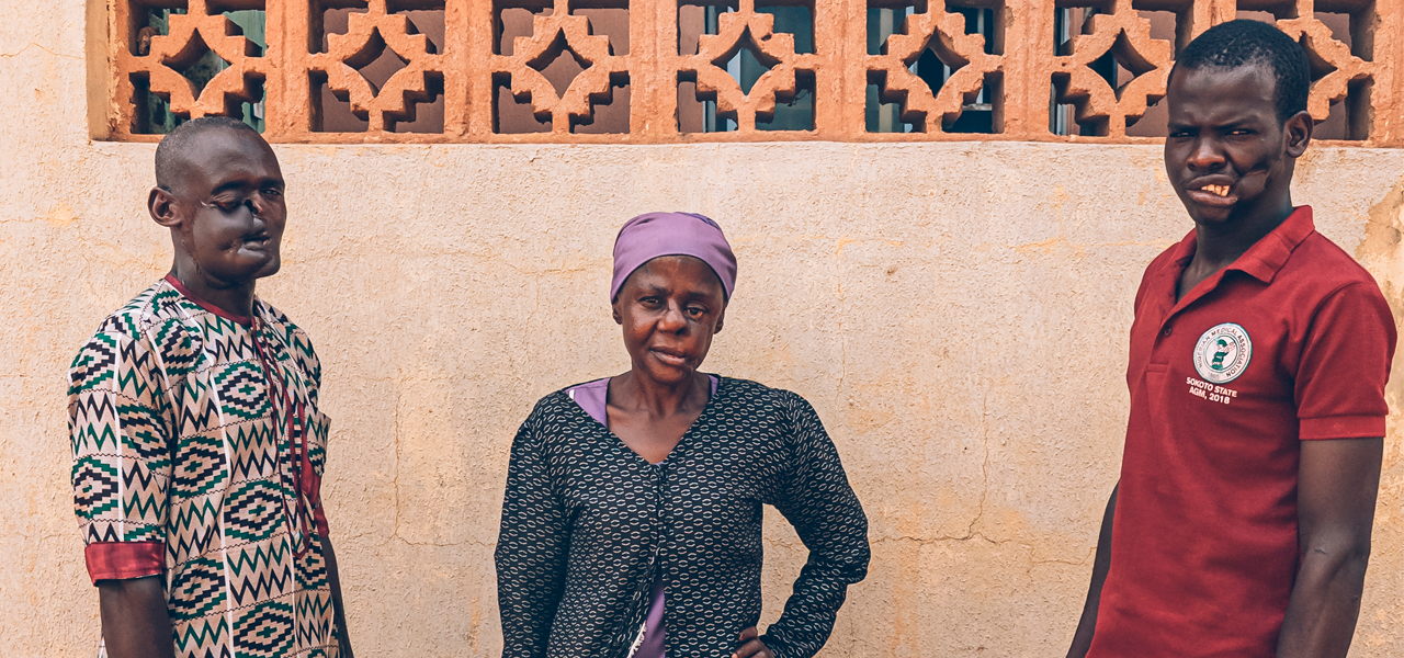 Noma, uma doença que não deveria mais existir: conheça três histórias ...